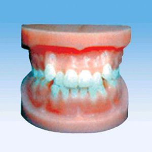 Rectify deformity teeth model-Teeth Models-Henan BOME supply chain ...
