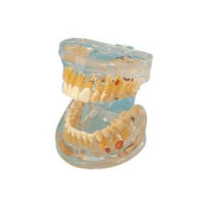 Transparent adult tooth model-Teeth Models-Henan Bomn supply chain ...